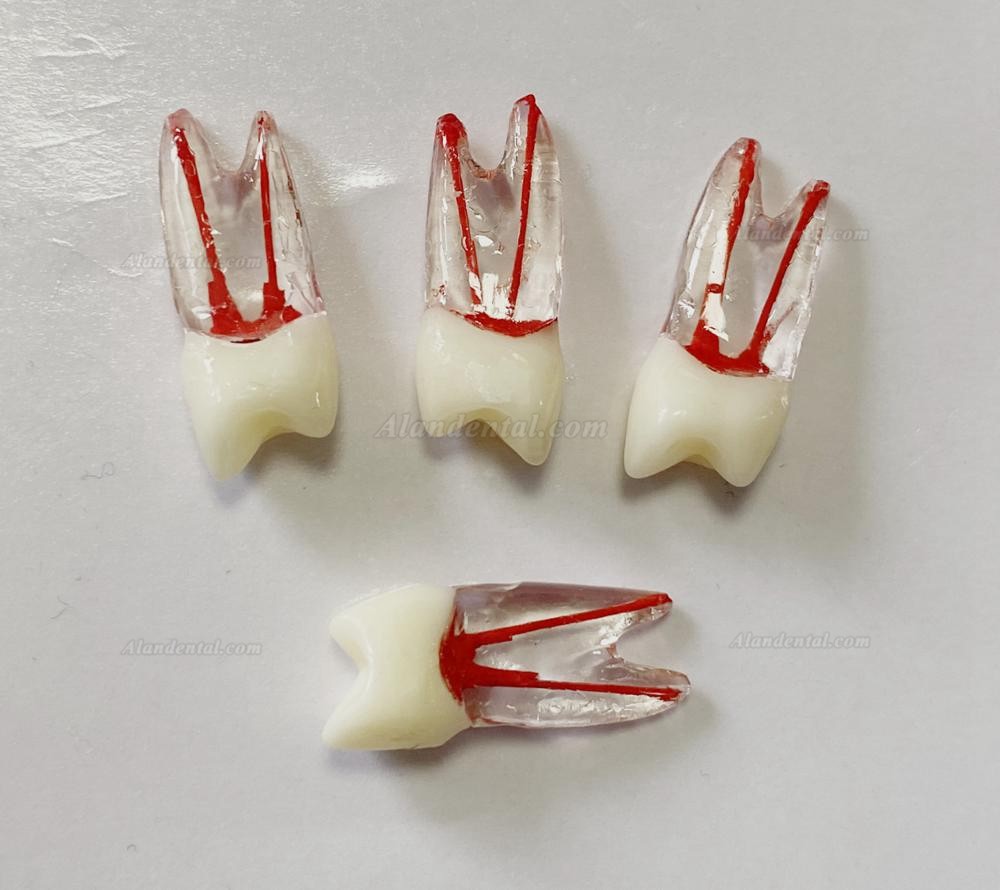 Buy Cheap Dental Teeth Model Endo Files Practise Molar Upper Lower ...