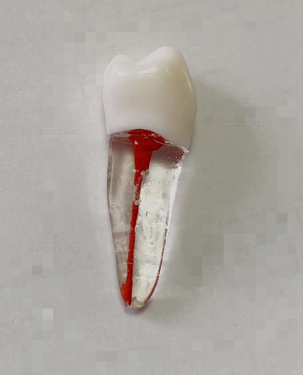 Endodontics Medical, Lab & Dental Supplies 1Pcs Dental Dentist School ...