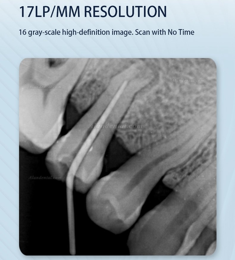 Buy Cheap Dynamic DDT-100A Dental Digital Phosphor Plate Scanner PSP X ...