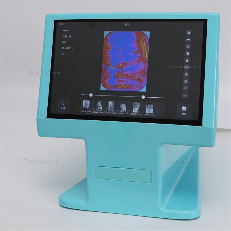 Buy Cheap Dynamic DDT-100A Dental Digital Phosphor Plate Scanner PSP X ...