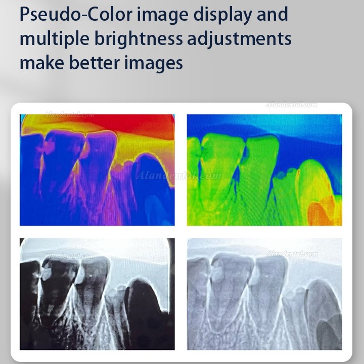 Buy Cheap Dynamic DDT-100A Dental Digital Phosphor Plate Scanner PSP X ...