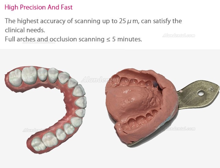 Buy Cheap Fussen Dental 3D Digital Intraoral Scanner Alandental.com ...