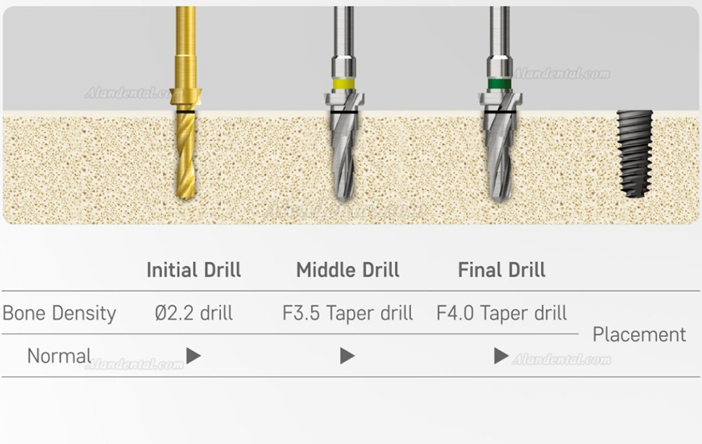 Buy Cheap Osstem Hiossen Taper Surgical Kit with Torque Wrench (Use for ...